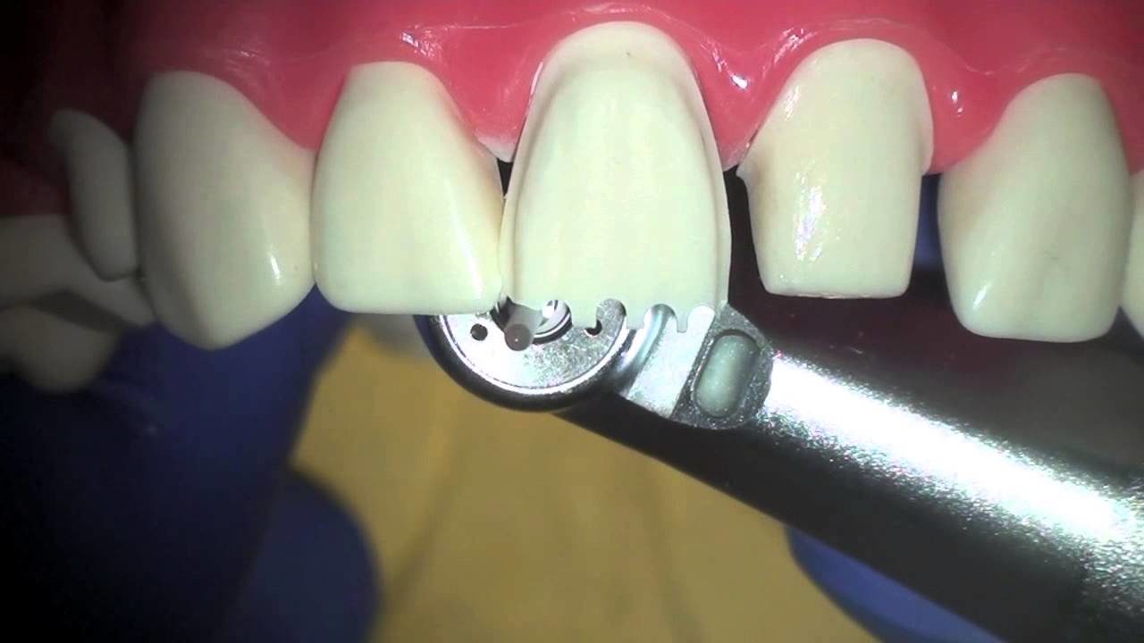 Esthetic Dentistry - sscdsguide